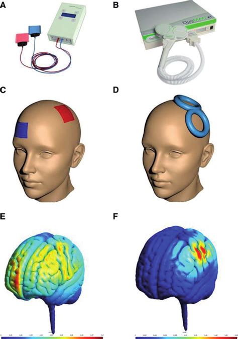 Examples Of Commercial A Transcranial Direct Current Stimulation And Download Scientific