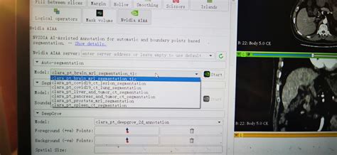 Nvidia Aiaa 无法自动分割肝脏 问题求助 3dslicer中文论坛