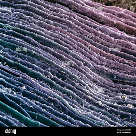 Nerve Fibres Coloured Scanning Electron Micrograph Sem Of Parallel
