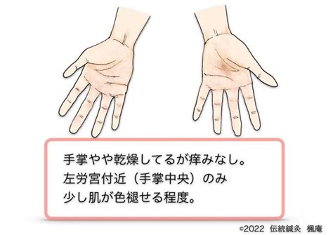 No