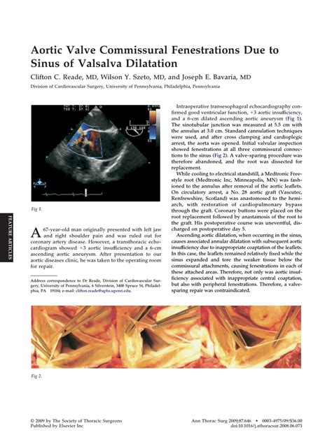 Pdf Aortic Valve Commissural Fenestrations Due To Sinus Of Valsalva
