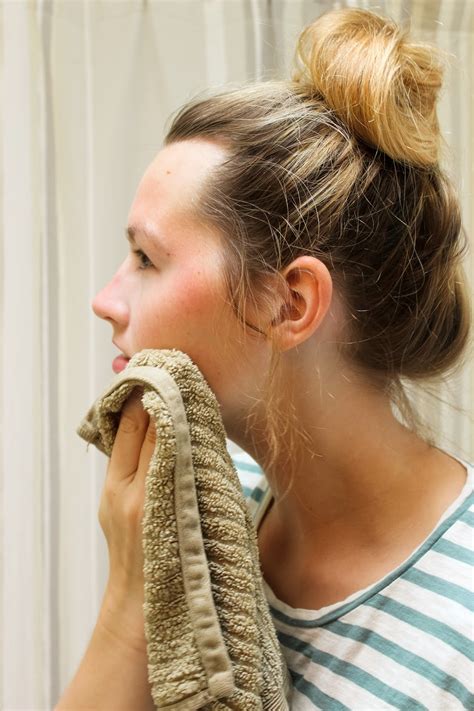 The Black Barcode Getting Clear Skin Just In Time For Babe With AcneFree