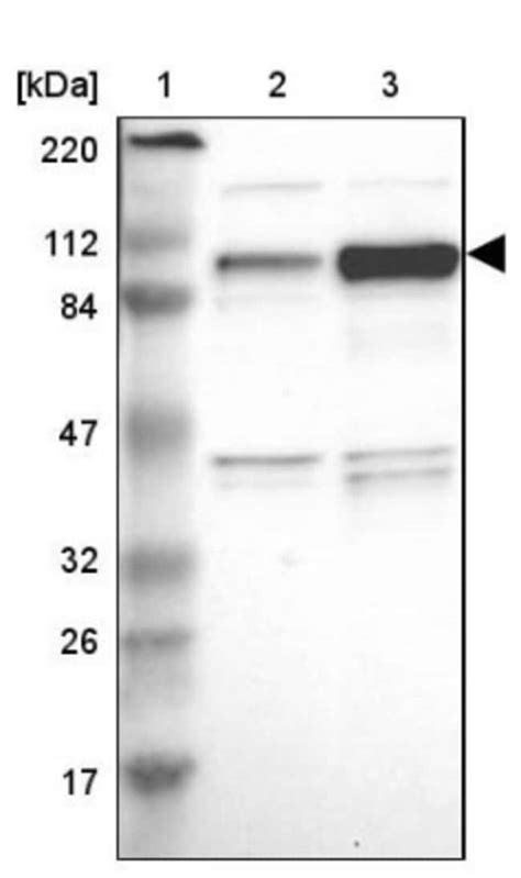 Ncaph 01 Ml