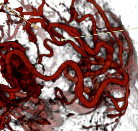 Medical Image Visualization Ap Lab