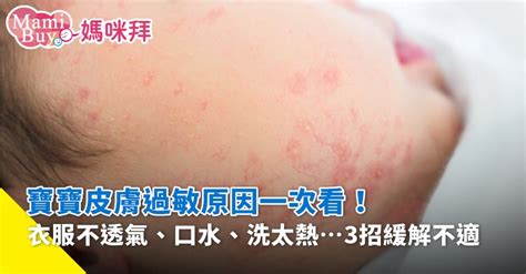 皮膚過敏種類如何區分？常見過敏皮膚症狀與皮膚過敏的治療方法｜mamibuy編輯部 媽咪拜mamibuy