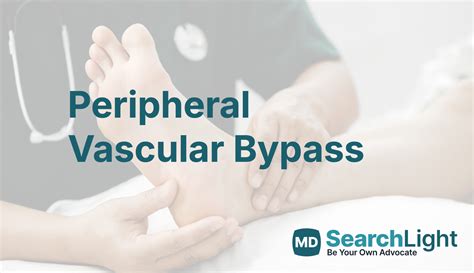 Peripheral Vascular Bypass Peripheral Bypass Surgery Md Searchlight