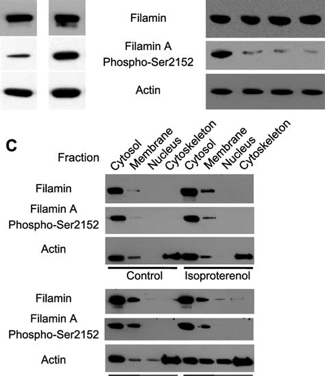 Isoproterenol And Thrombin Alter Filamin Serine 2152 Phosphorylation In
