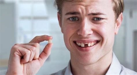 Comment Enlever Le Tartre Des Dents Naturellement 7 Astuces Maisons