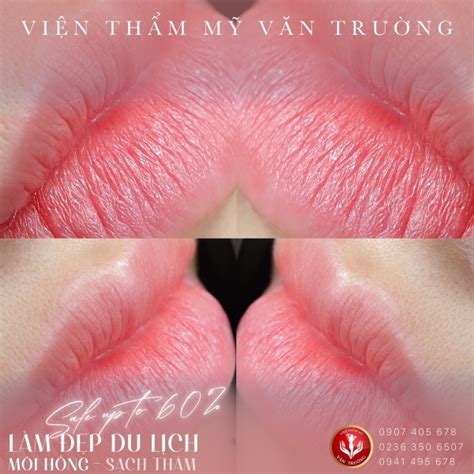 Viện Thẩm Mỹ Văn Trường Thẩm Mỹ Uy Tín Tại Đà Nẵng