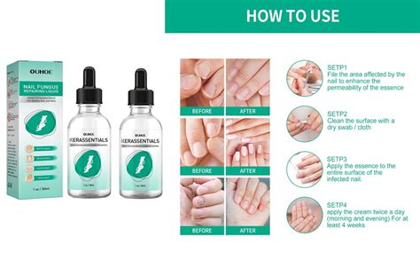 Kerassentials Nails Nutrient Oilkerassentials Toenail Oil