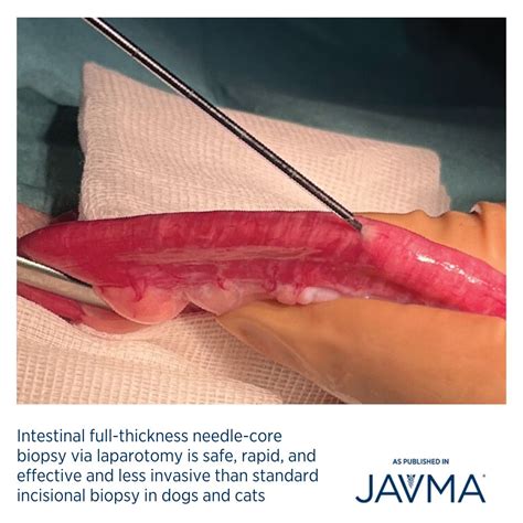 Needle Core Biopsy Was Safe Rapid And Effective And Was Less Invasive Than Standard Incisional