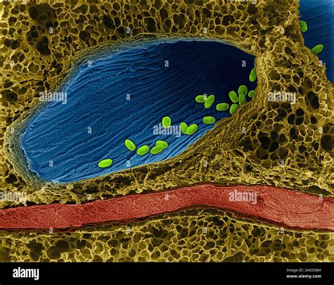 Coloured Scanning Electron Micrograph Sem Of Photocomposite Of Bacillus Anthracis Spores In
