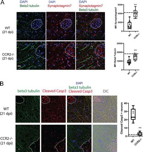 Ccr2 Pathway Promotes Regional Defects In The Production Of
