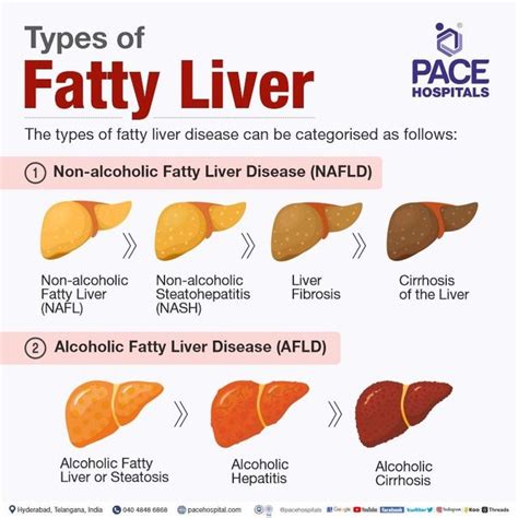Fatty Liver Disease Dark Urine