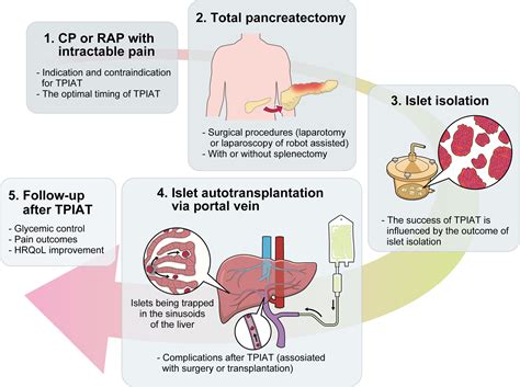 Current status of total pancreatectomy with islet autotransplantation for chronic and recurrent ...