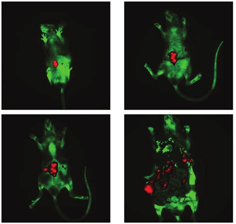 Dual Fluorescence Imaging In Vivo In Tumor Bearing Transgenic GFP Nude