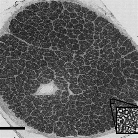 Microscope Image Of Full Optic Nerve Cross Section Used For Download Scientific Diagram