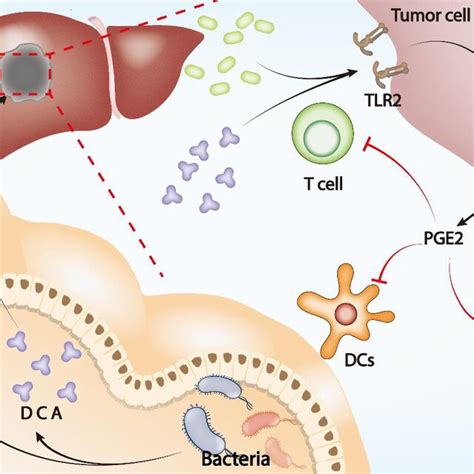 Gut Microbiota Influences Tumor Microenvironment Through The Gut Liver