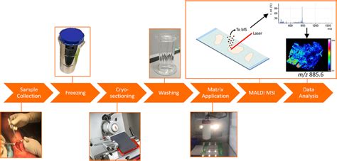 General MALDI MSI Workflow Applied To Fracture Hematoma Analysis The