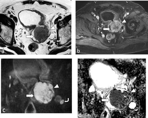 Vi Steps To Achieve Vi Rads Assessment European Journal Of Radiology