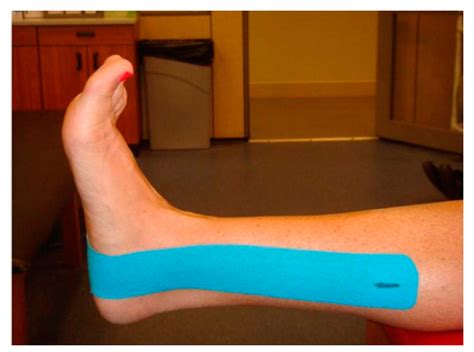 How To Use Kinesiology Tape Ankle At Richard Davis Blog