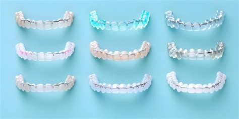 Orthodontic Dental Care For Alignment And Correction Of Teeth And Jaws