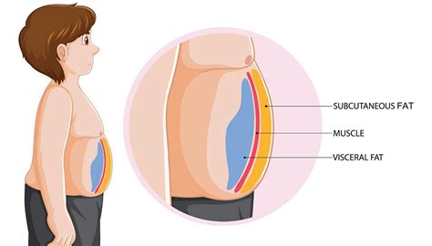 What Is Visceral Fat And Why Should You Reduce It — Feel Fresh Nutrition