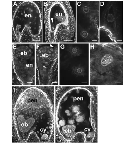 Microscopic Analysis Of Seeds Produced From Heterozygous Jf1781 Plants