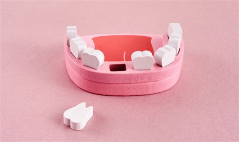 The Importance Of Replacing Missing Teeth Options And Benefits