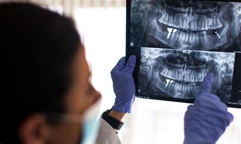 Does Bone Grow Back After An Apicoectomy Pristine Oral Surgery