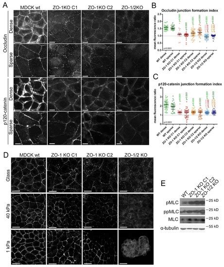 Zo 1 Guides Tight Junction Assembly And Epithelial Morphogenesis Via