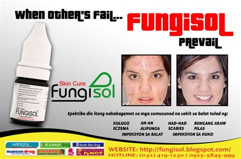 Fungisol Advertisement By Marilyn Sisa At