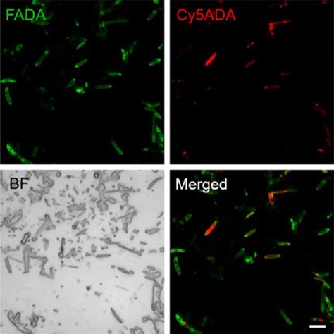 Confocal Fluorescence Imaging Of The Fdaa Labeled Gut Microbiota Using