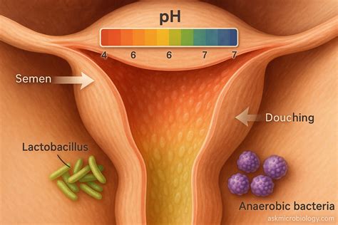 Sex Ph And The Microbiome Why Bv Symptoms Flare Ask Microbiology