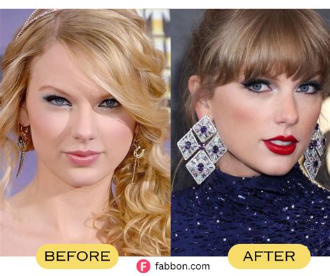 All 7 Plastic Surgeries Taylor Swift Underwent As Per Medical Experts