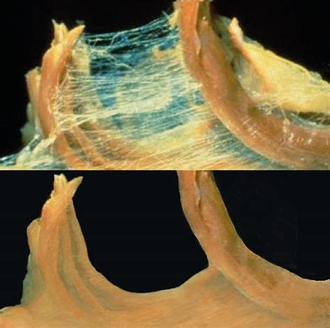 Scar Tissue Muscle And Joint Clinic The Leading Soft Tissue Treatment Center