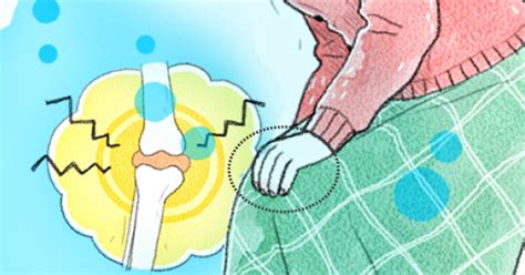류머티즘관절염 겨울철 실내습도 유지하고 스트레칭 필수