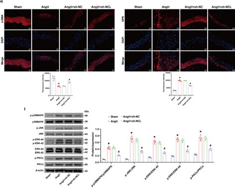 Nucleolin In The Cell Membrane Promotes Ang Ii Mediated Vsmc Phenotypic