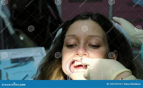 Dentist Puts The Cotton Wool In His Mouth The Assistant Removes Saliva