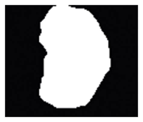 The Results Of Cytoplast A Original Image B Regions Of Bacteria