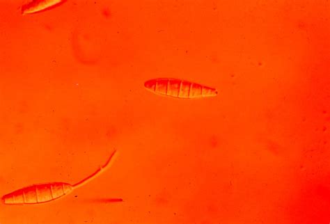 M522 2 Microsporum Gypseum Macroconidia Interference Micr… Flickr