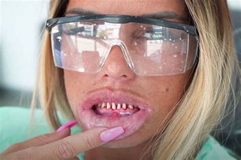 Brits Warned Of Turkey Teeth Dangers As 22 Die Following Surgery