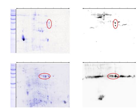 Figure Two Dimensional Electrophoresis And Respective Download
