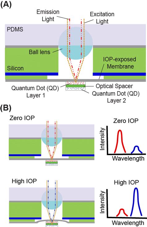 A The Architecture Of The Iop Microsensor B The Working Principle