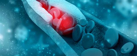 Clinical Trialscardiac And Vascular Disease