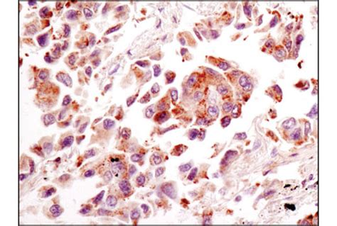 Ragc D31g9 Xp® Rabbit Mab Cell Signaling Technology