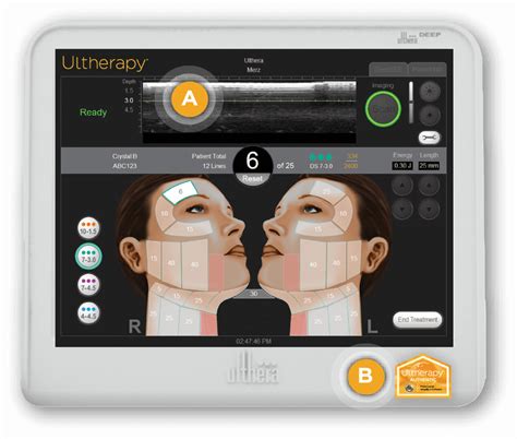 Beauty Test Drive Ultherapy By Dr Kevin Chua Medical And Aesthetics