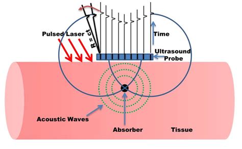 4 Backprojection Pat Image Reconstruction For A Planar Detection Download Scientific Diagram