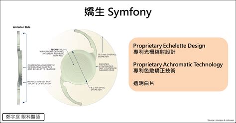 鄭宇庭眼科醫師Dr Jeng 人工水晶體廠牌介紹長延焦段