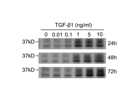 Tgf β1 Induces Ctgf Expression In A549 A549 Cells Were Incubated For